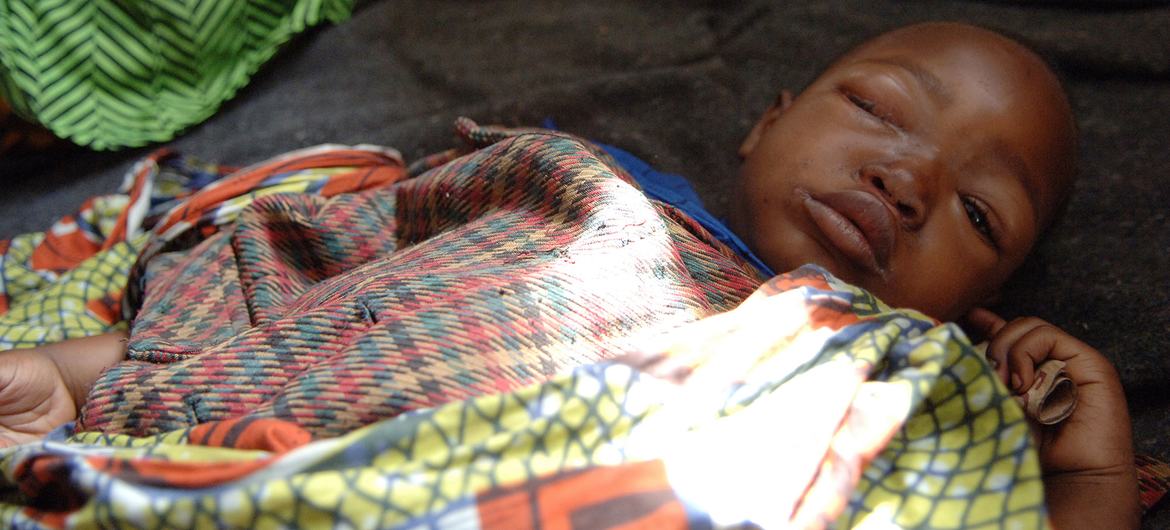 Monkeypox: How it spreads, who’s at risk – here’s what you need to know ...