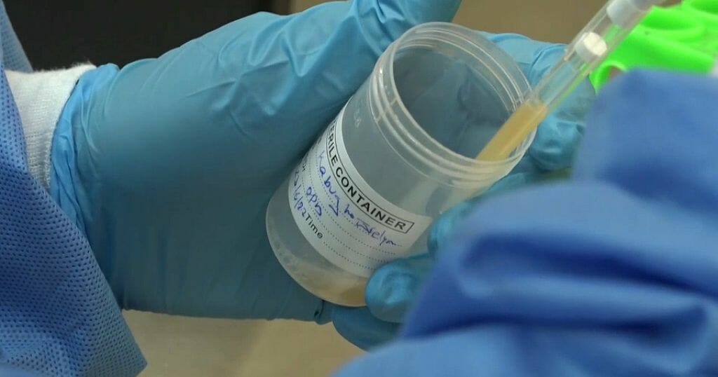 Equatorial Guinea confirms outbreak of Marburg virus, nine persons dead ...